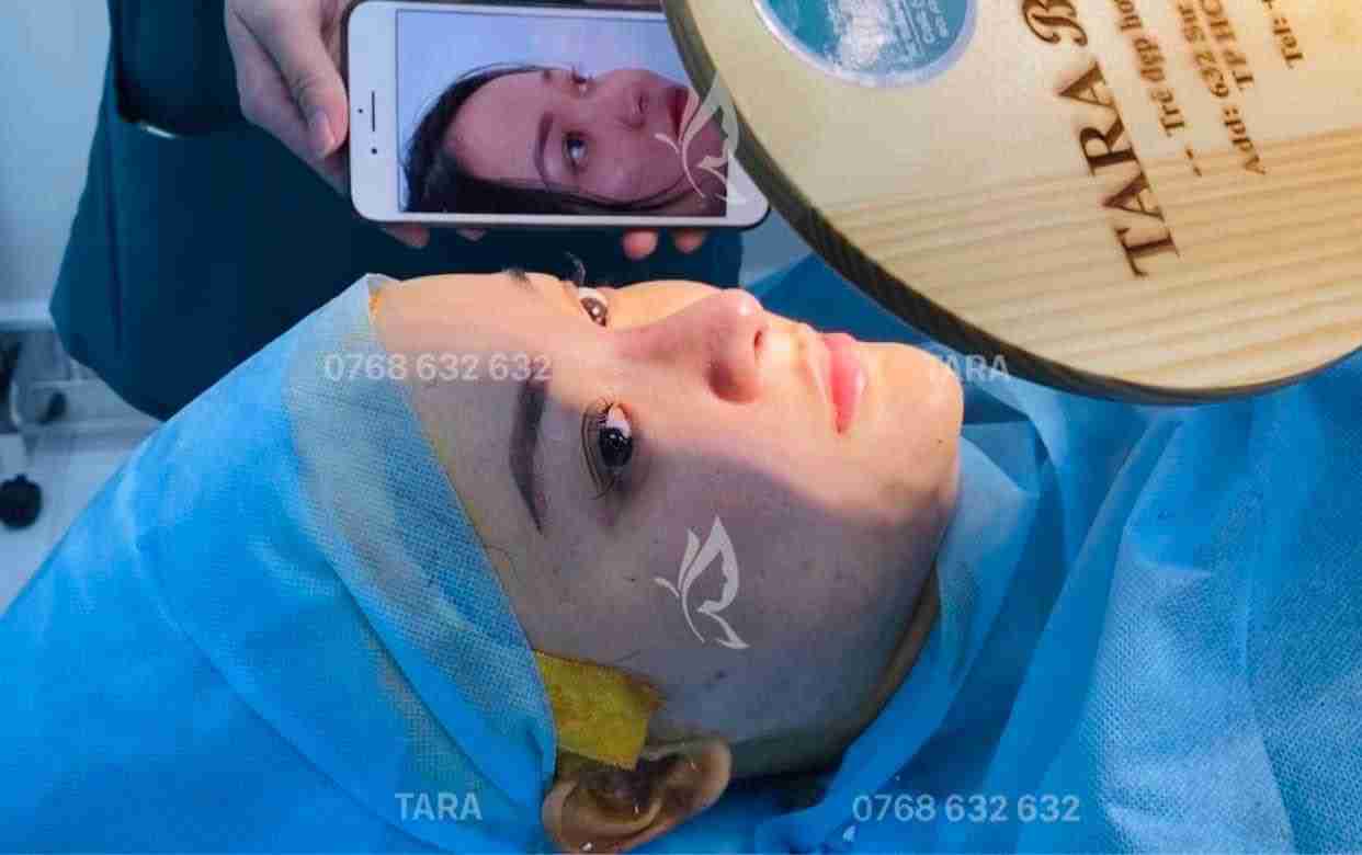 Sửa mũi có đau không? “GÂY TÊ ĐA TẦNG" by Dr Trang TARA