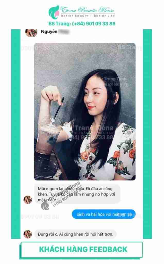 Mũi diều hâu hay mũi két là gì? Có nên sửa hay không?