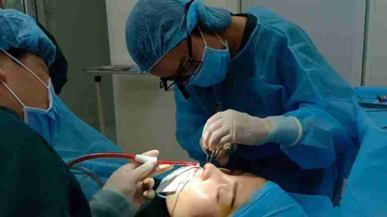 Nâng mũi Surgiform là gì? Có bị co rút không?